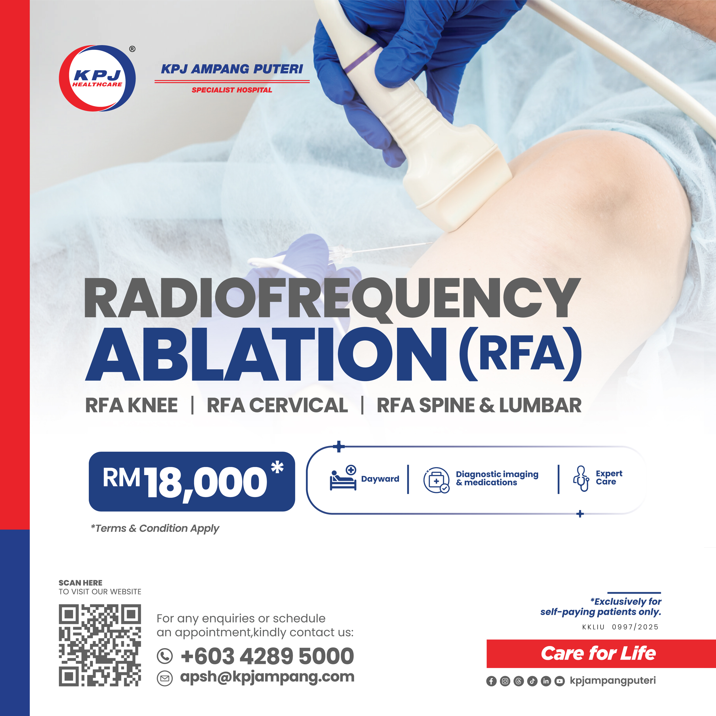 Radiofrequency Ablation (RFA)